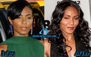 Jada Pinkett Smith Plastic Surgery Before and After Photos