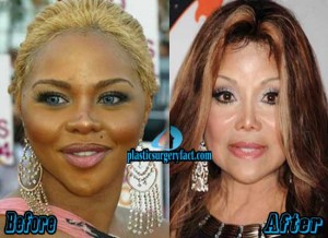 Lil Kim Plastic Surgery Before and After Pictures