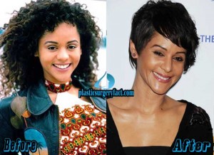 Persia White Plastic Surgery Before And After Photos
